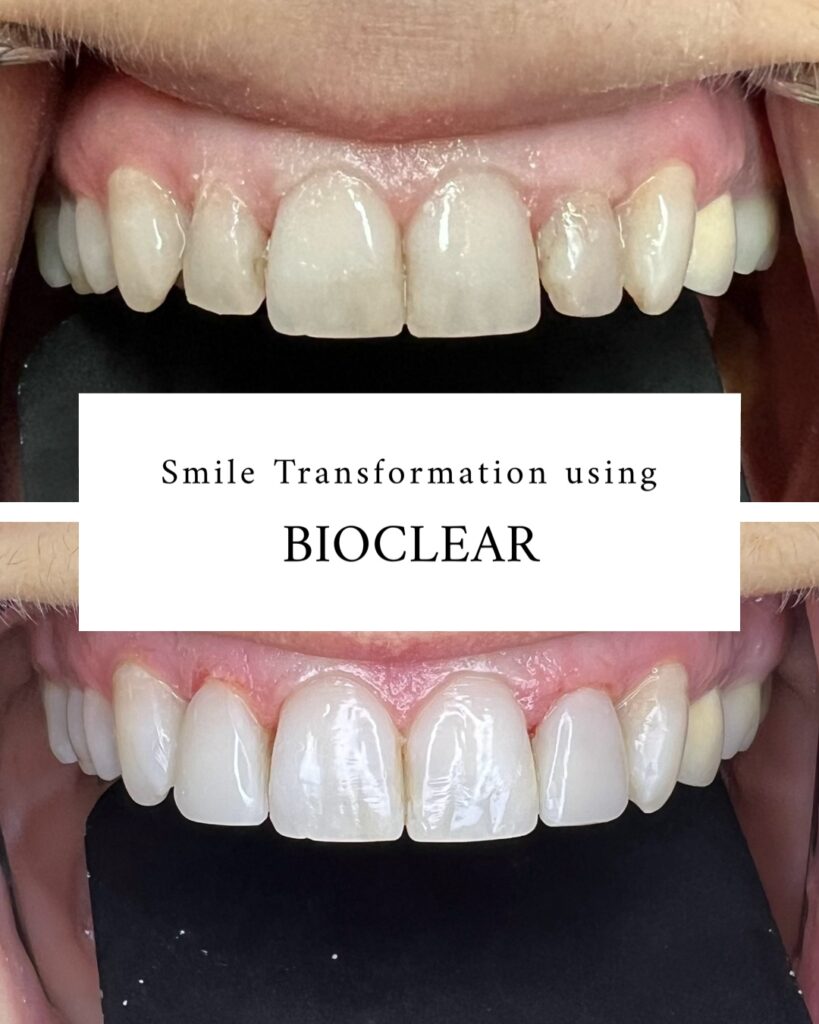 BIOCLEAR®