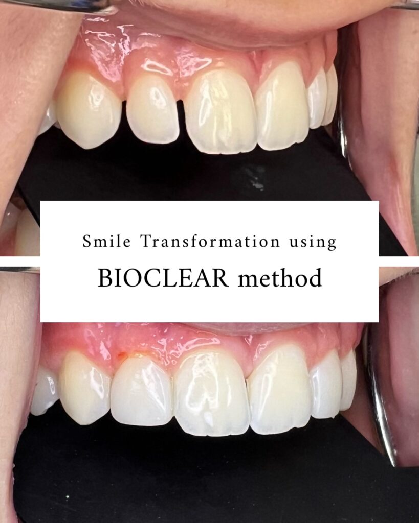 BIOCLEAR®